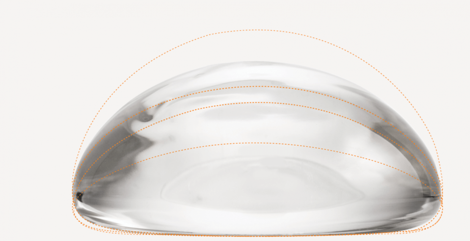 Breast Implants in Beverly Hills | Dr. Stuart Linder